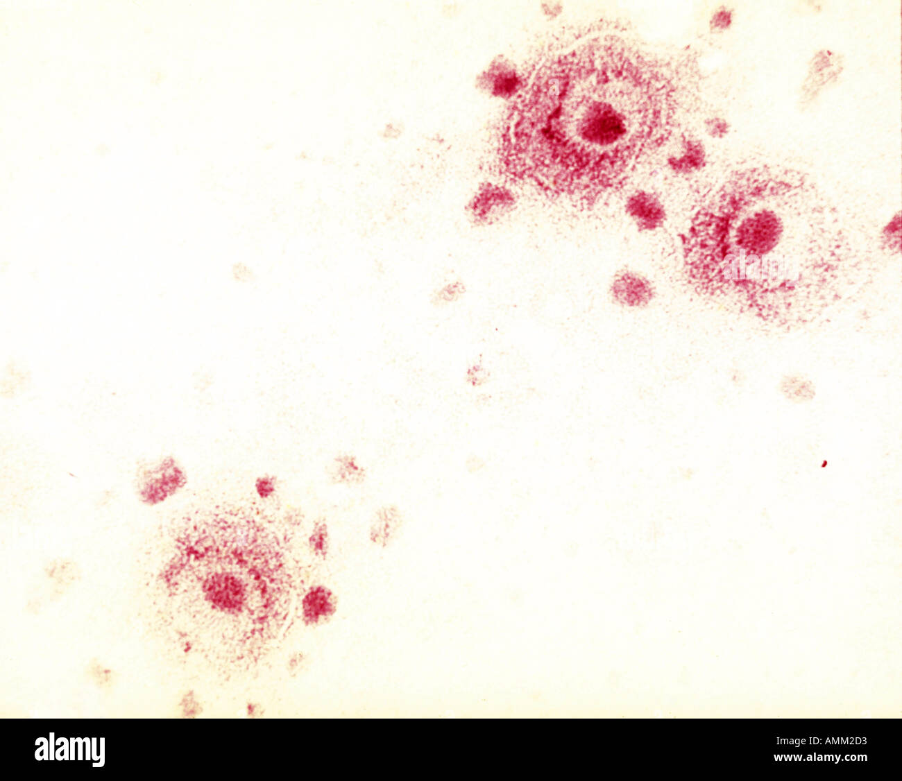 Varicella zoster micrograph Banque de photographies et d’images à haute ...