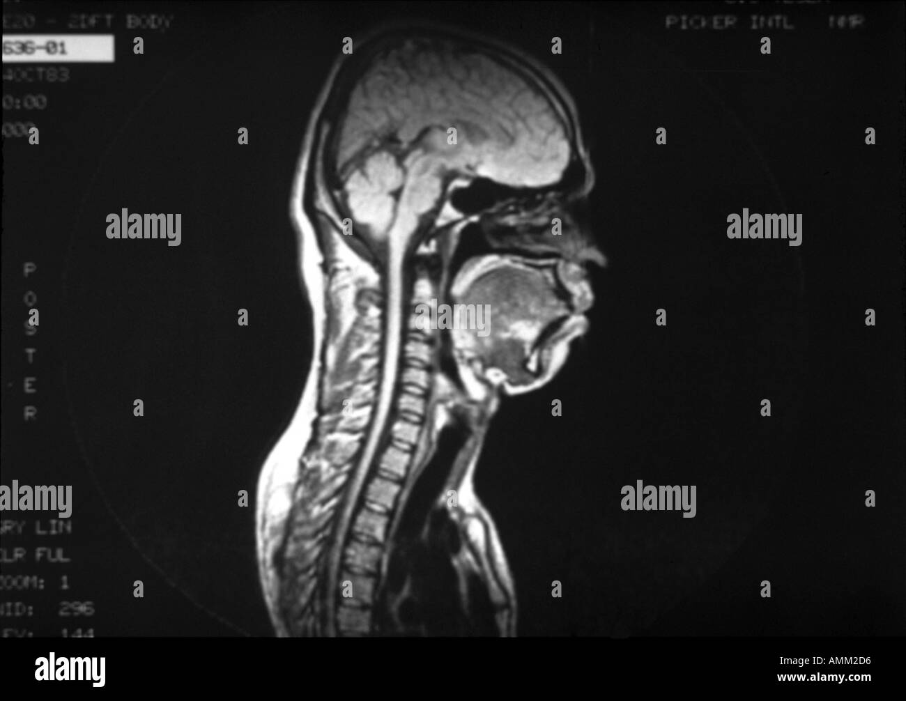 Anatomie du haut du corps Banque d'images noir et blanc - Alamy
