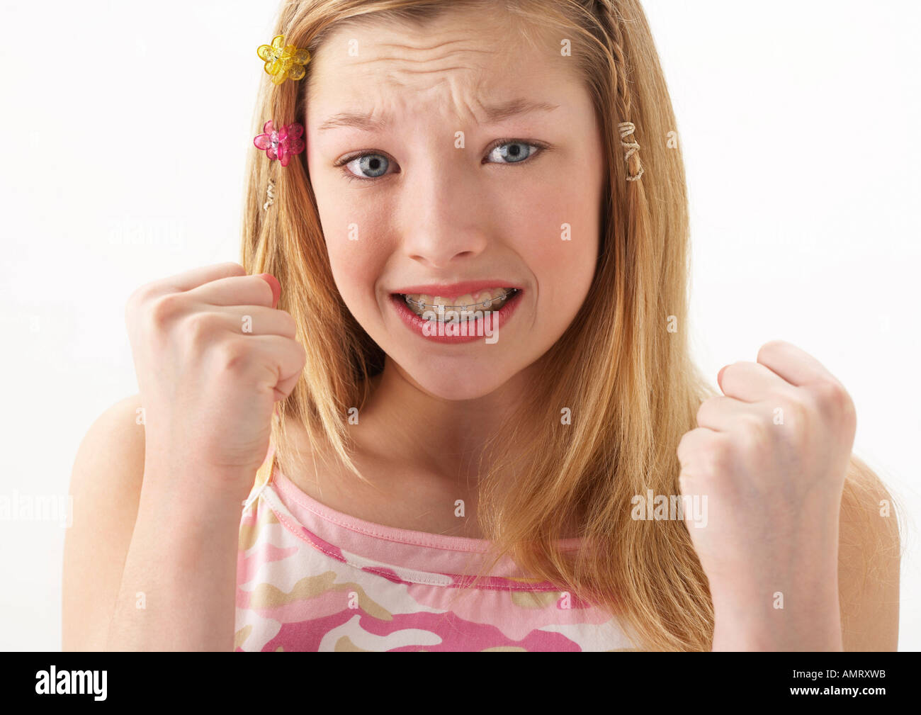 Teen Girl With Braces Closeup Banque De Photographies Et Dimages à