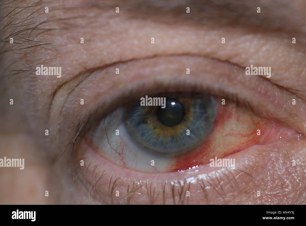 Inflamed eye Banque de photographies et d’images à haute résolution - Alamy