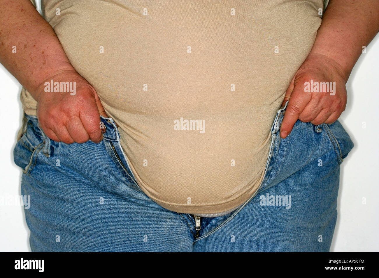 Morbid Obesity Banque d'image et photos - Alamy