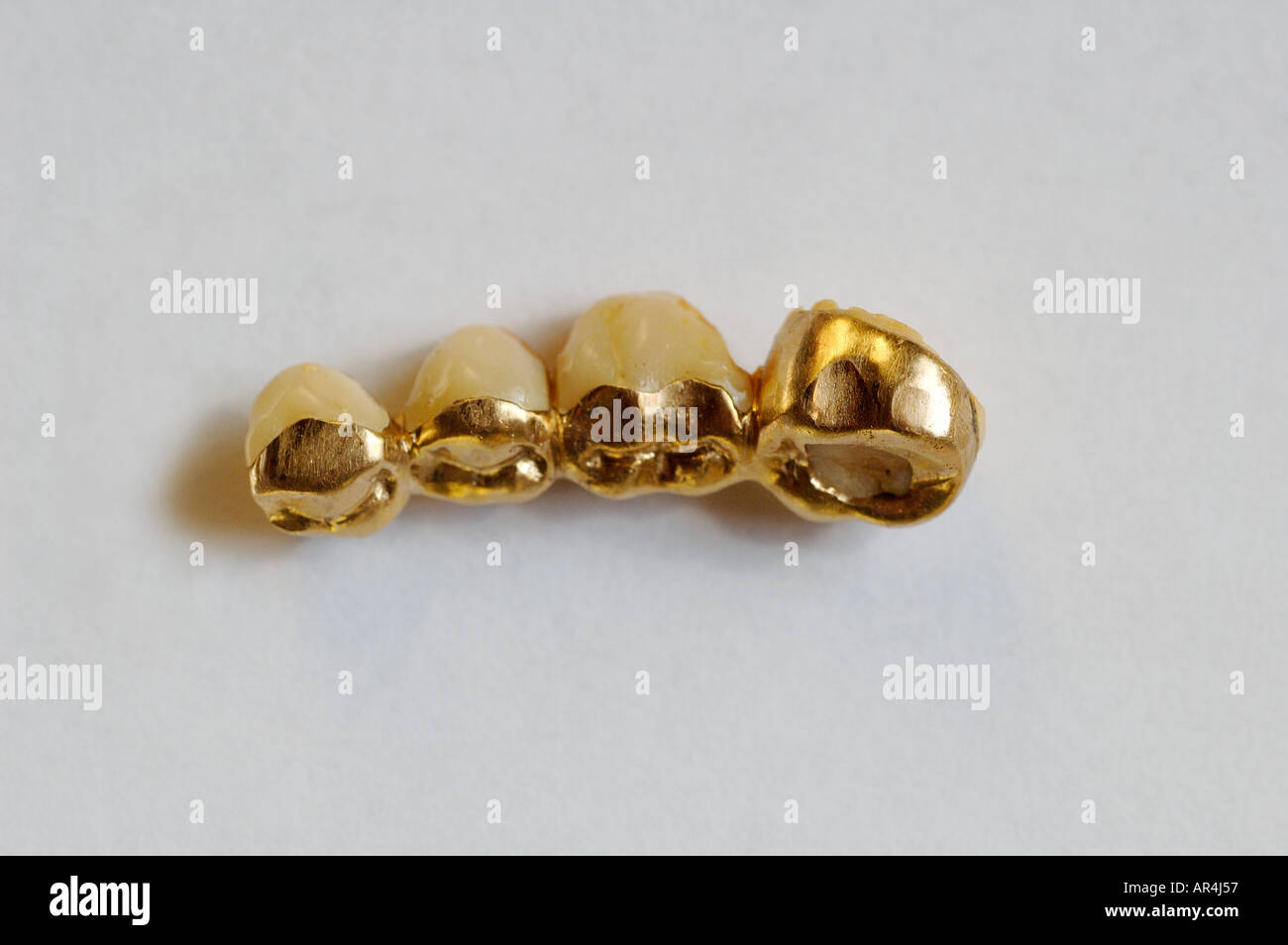 Dents en or Banque de photographies et d’images à haute résolution - Alamy