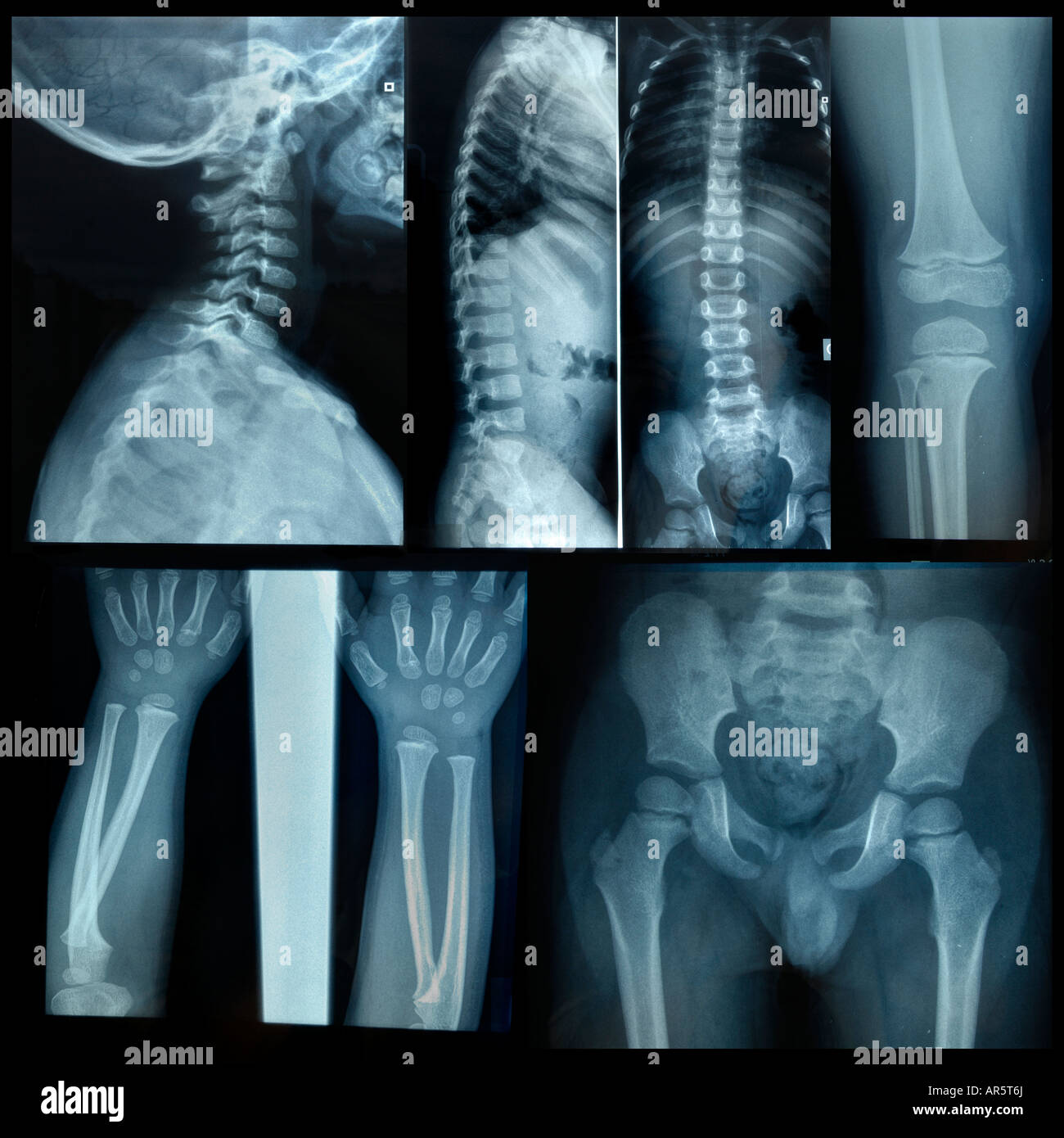 Anathomie du bras Banque de photographies et d’images à haute ...