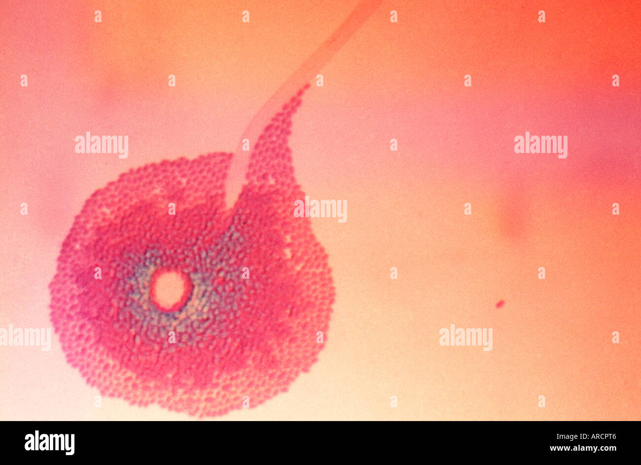 Un est un dermatophyte champignon parasite de la peau Photo Stock - Alamy