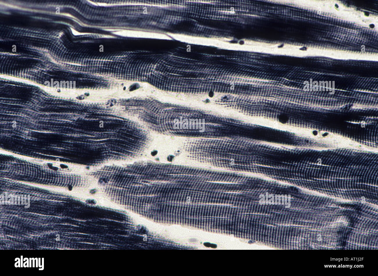 Tissu musculaire microscope Banque de photographies et d’images à haute ...