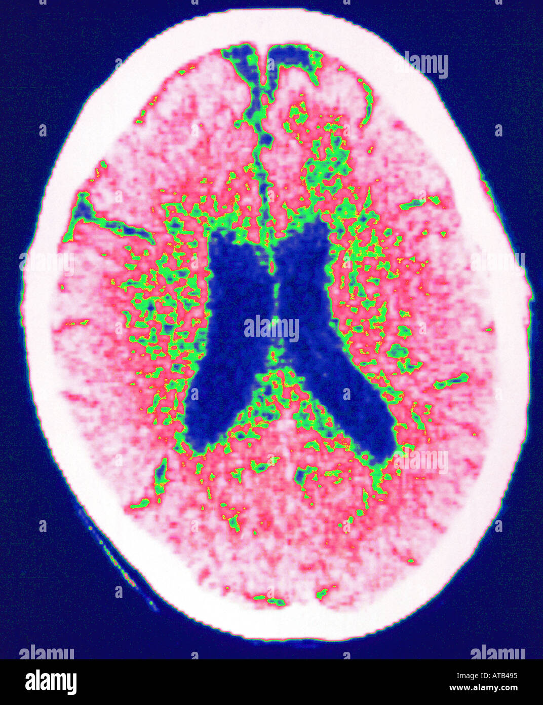 Parasite toxoplasma gondii Banque de photographies et d’images à haute ...
