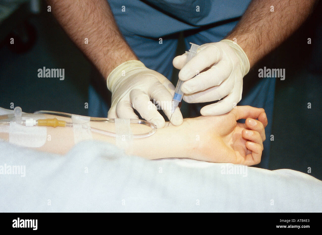 Gaz du sang artériel Photo Stock - Alamy