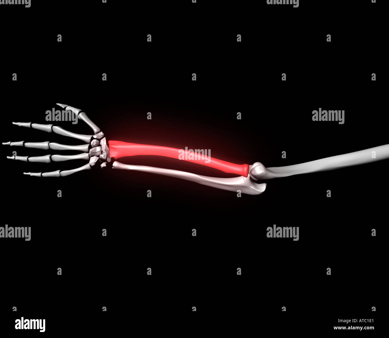 Squelette du bras Banque de photographies et d’images à haute ...