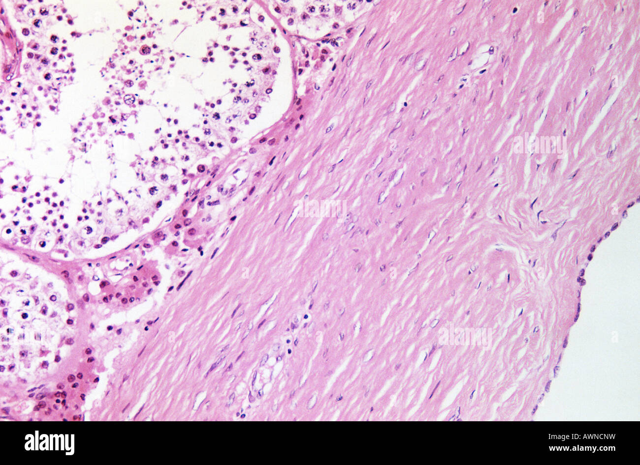 Histology testis Banque de photographies et d’images à haute résolution ...