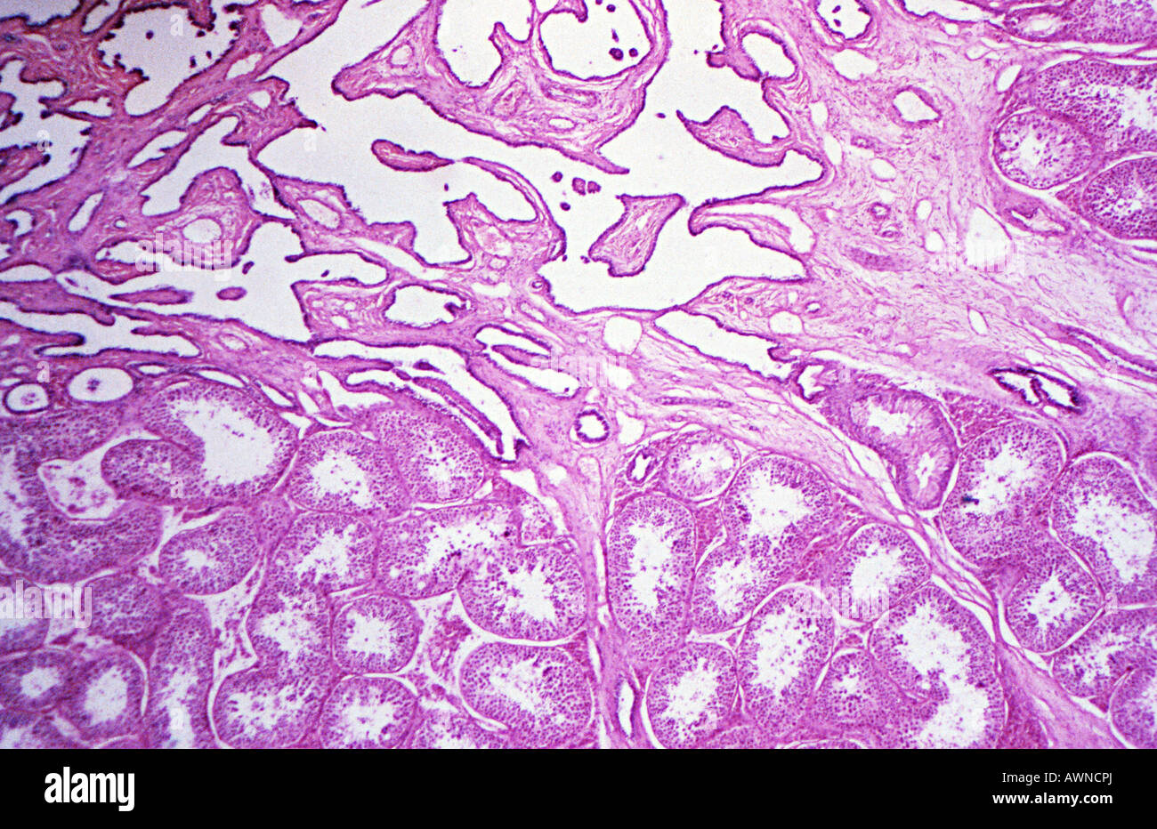 Histology testis Banque de photographies et d’images à haute résolution ...