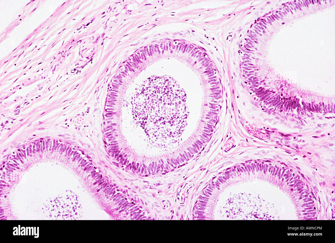 épididyme microscopie Banque de photographies et d’images à haute ...