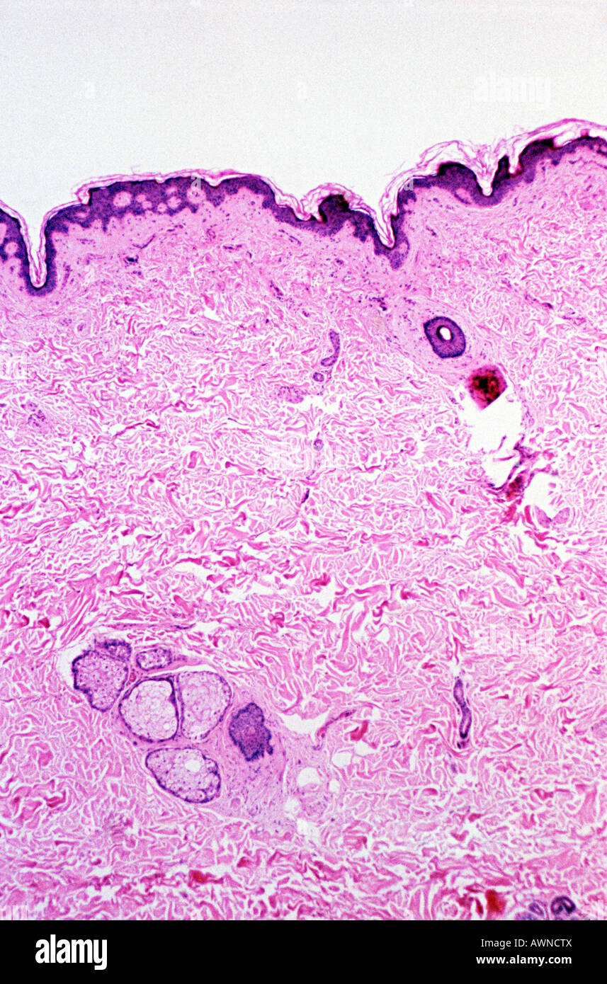 Cellule cutanée Banque de photographies et d’images à haute résolution ...