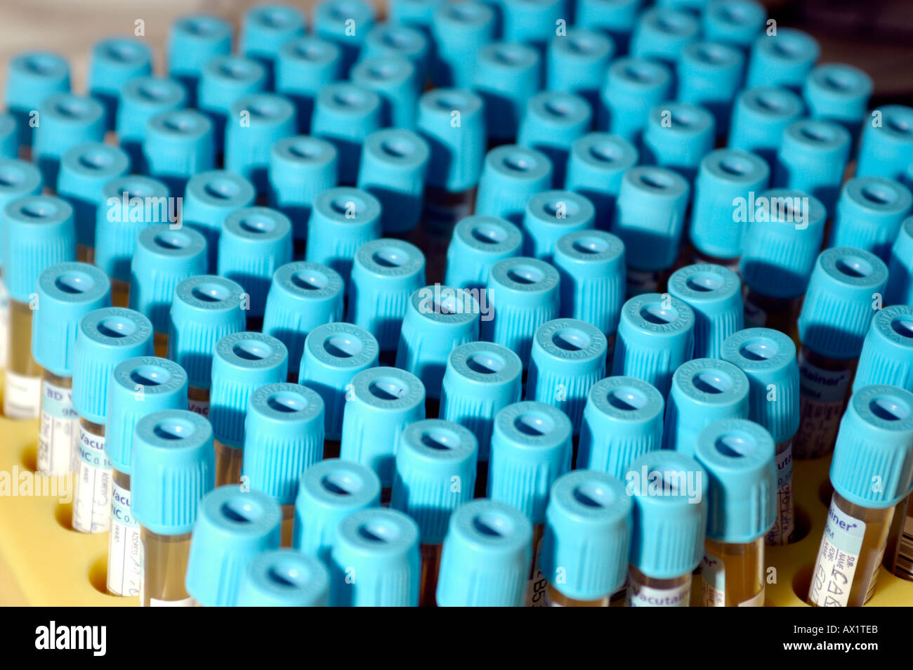 Test de coagulation Banque de photographies et d’images à haute ...