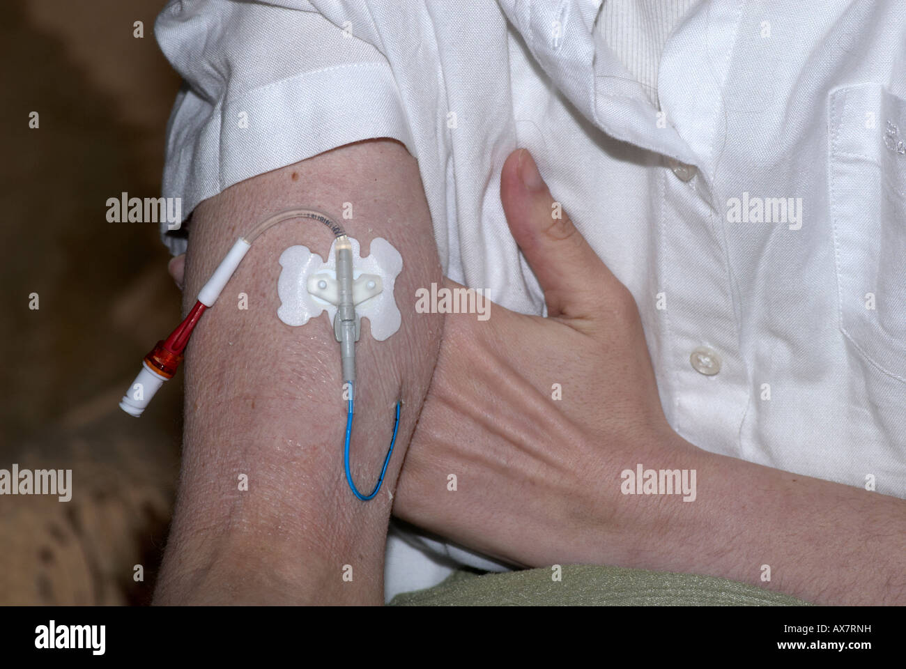 Picc line cancer Banque de photographies et d’images à haute résolution ...