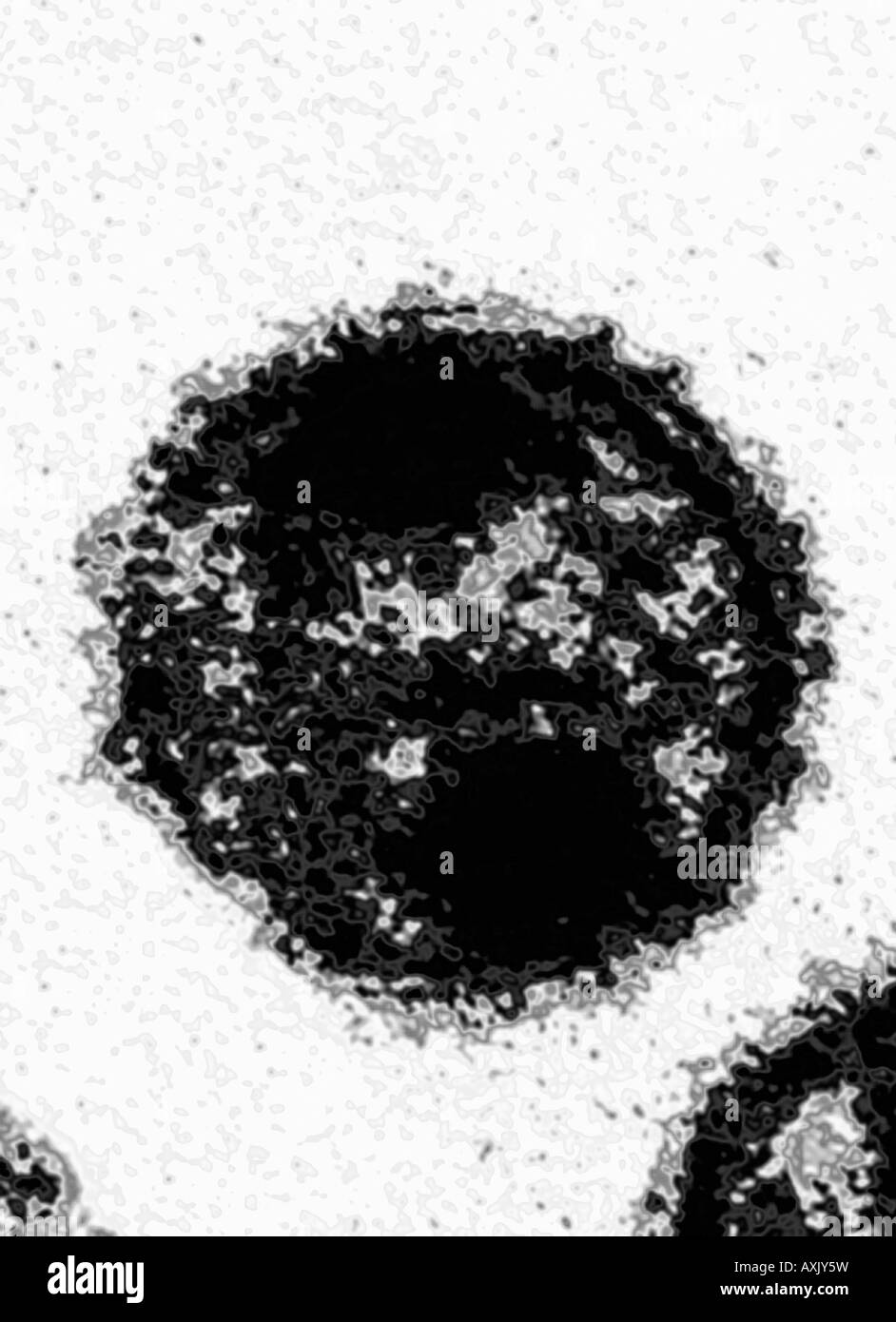 Microscope électronique vih sida Banque de photographies et d’images à ...