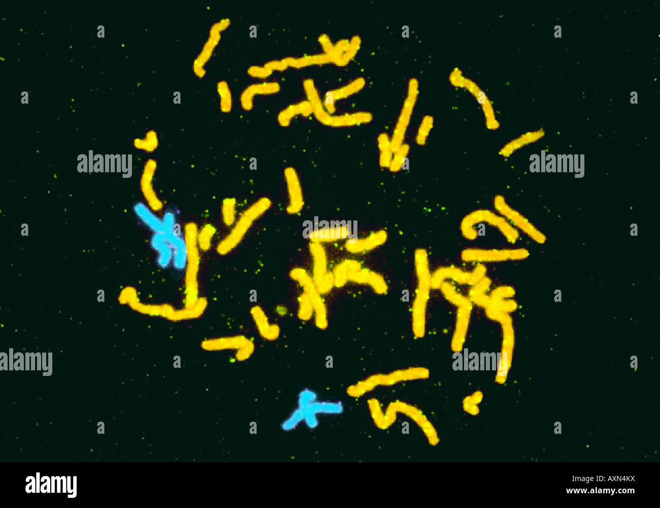 Chromosomes humains Banque de photographies et d’images à haute ...