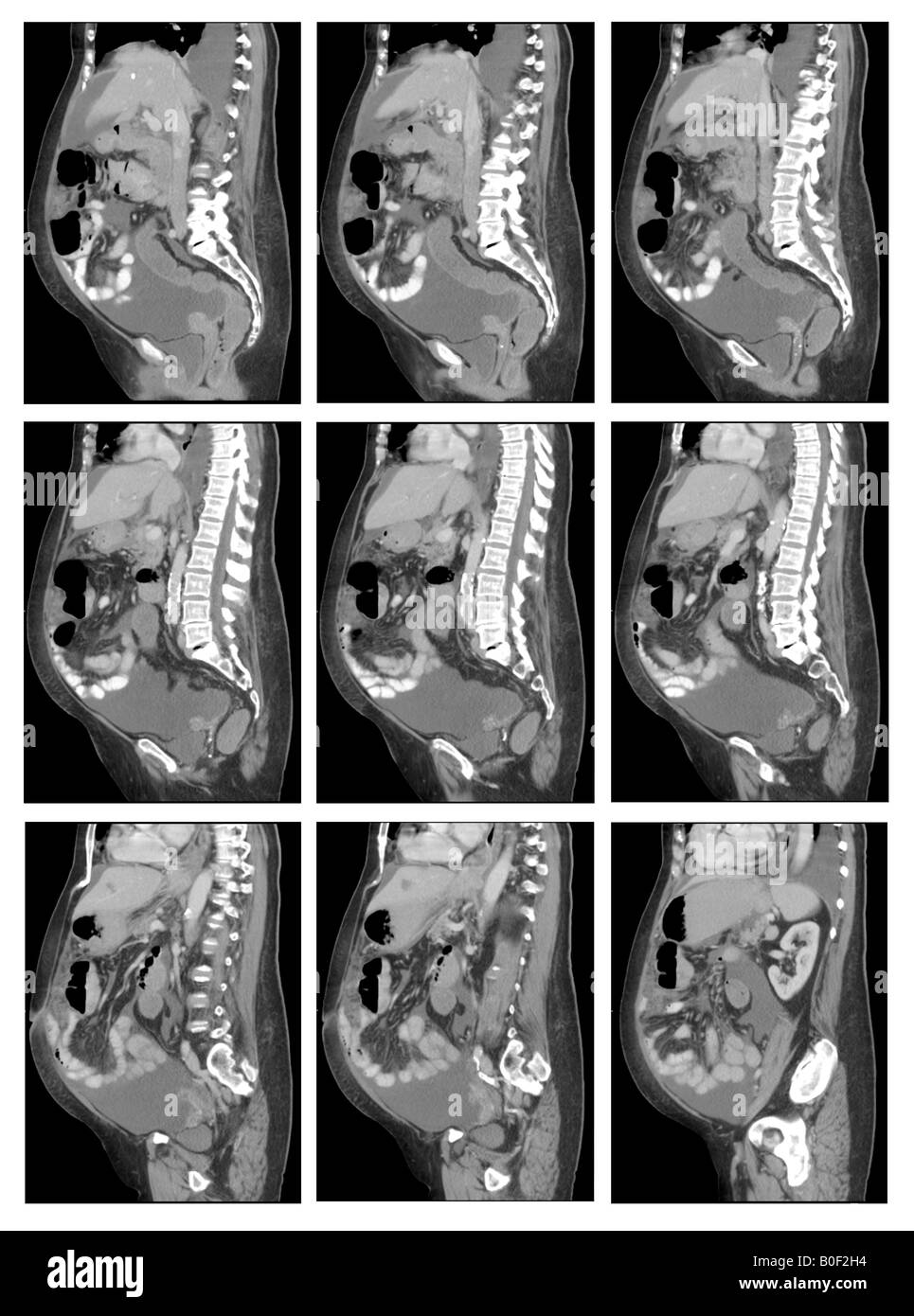 Cat scan of the female pelvis Banque de photographies et d’images à ...