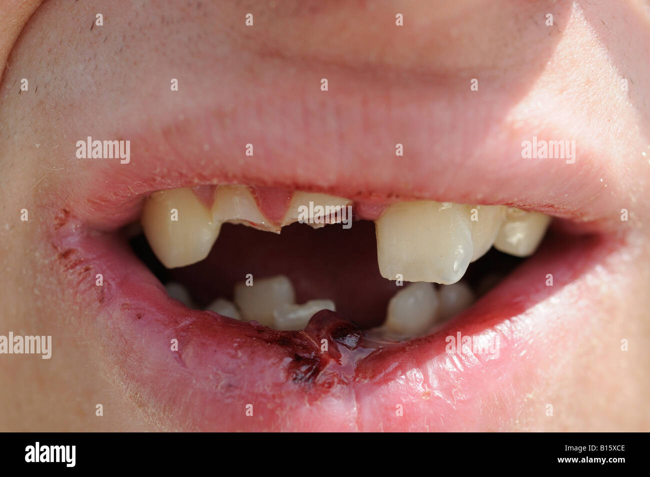 Visage defiguré par la douleur Banque de photographies et d’images à ...