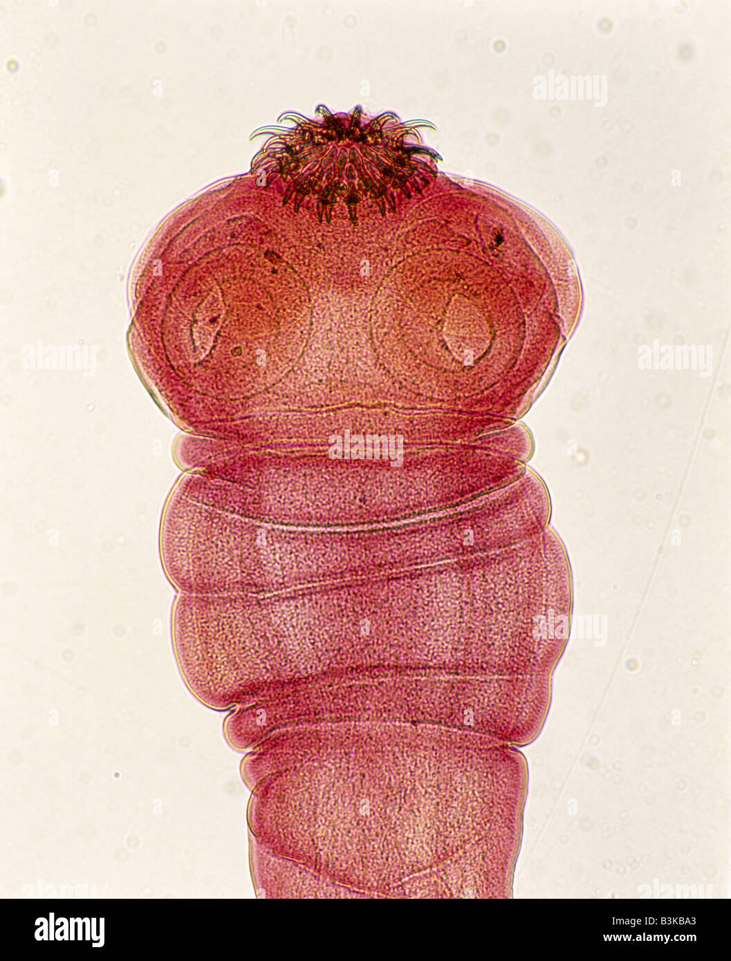 Taenia solium Banque de photographies et d’images à haute résolution ...