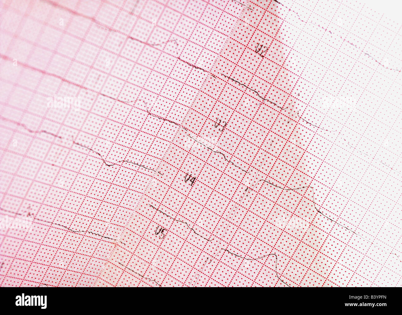 Rapport de cardiogramme Banque de photographies et d’images à haute ...