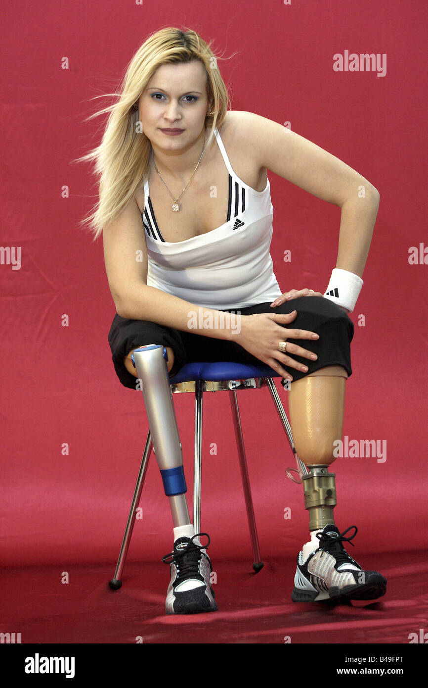 Woman amputated leg Banque de photographies et d’images à haute ...