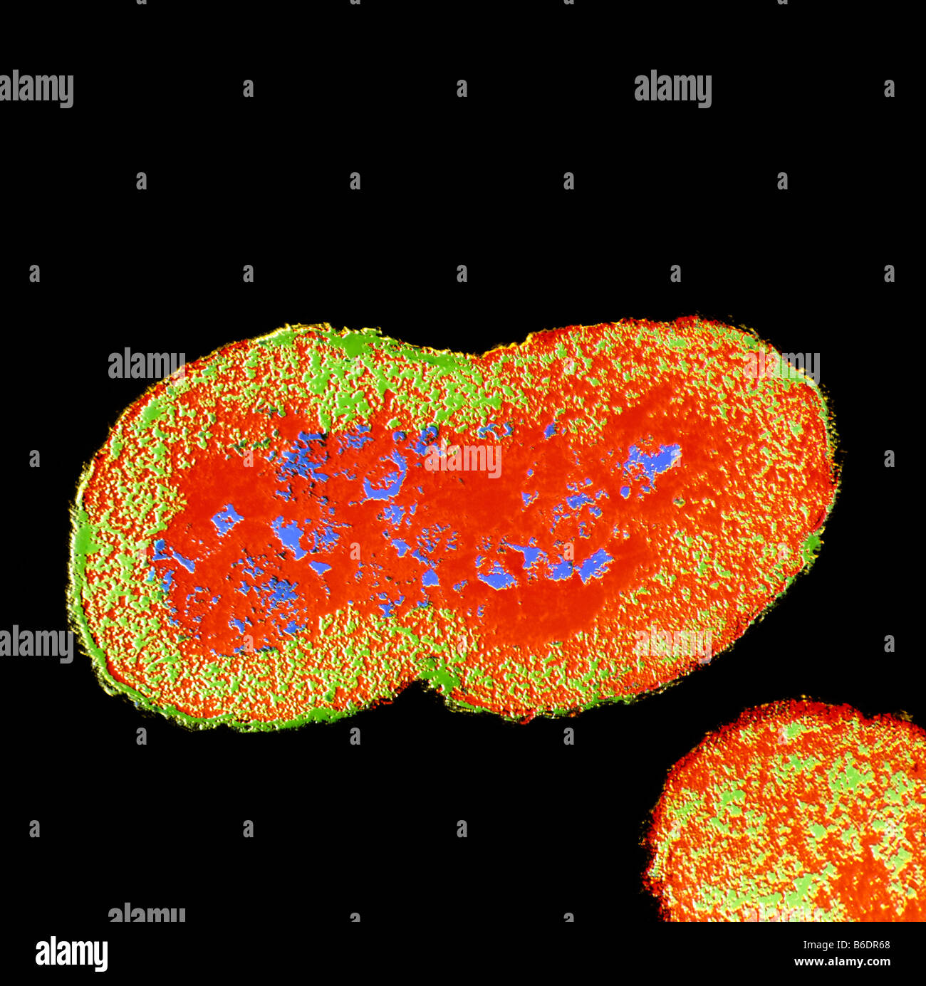 Le TEM de Neisseria gonorrhoeae les bactéries sont la cause de la ...