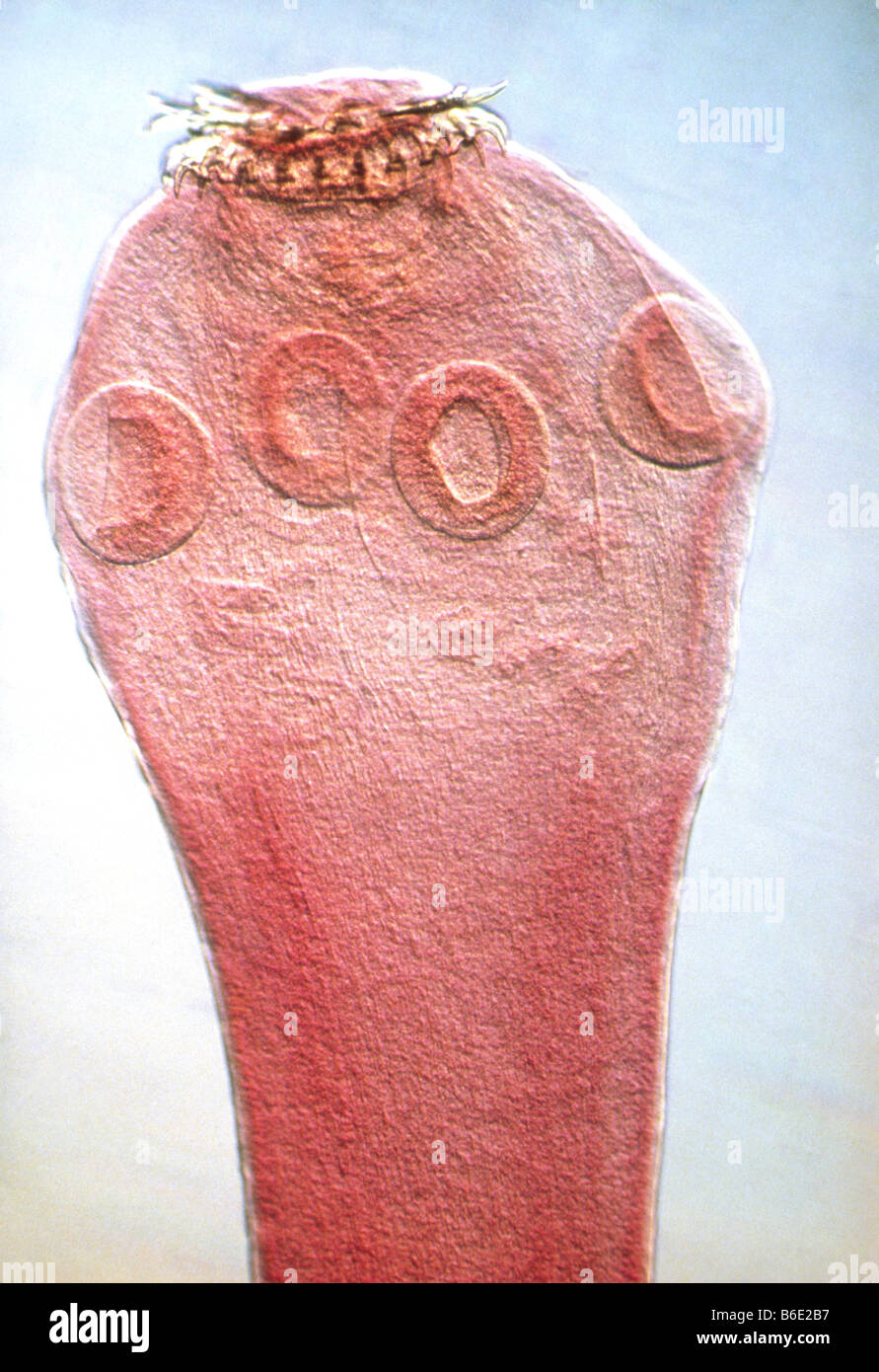 Le ténia, la lumière de la micrographie (chef- comme structure) d'un ...