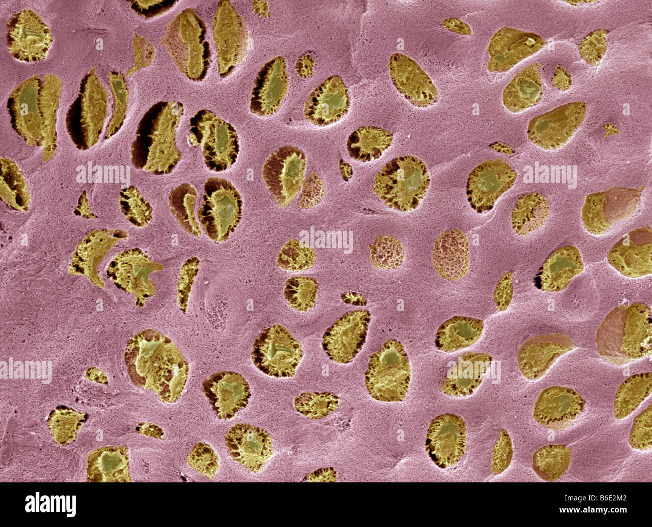 Le cartilage hyalin. Couleur de l'analyse des electronmicrograph (SEM ...