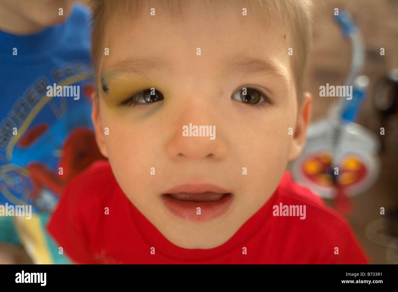 Orphelin à un orphelinat en Ukraine Photo Stock - Alamy