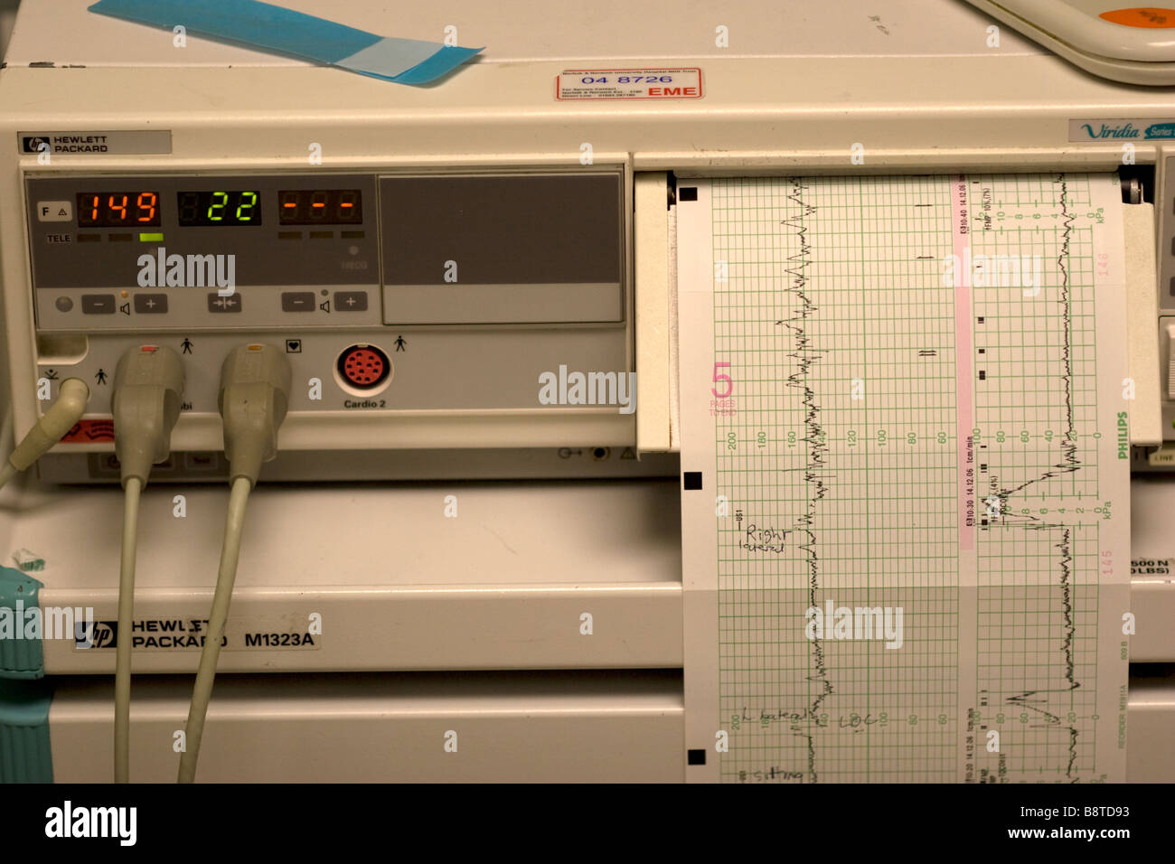 Moniteurs de fréquence cardiaque Banque de photographies et d’images à ...