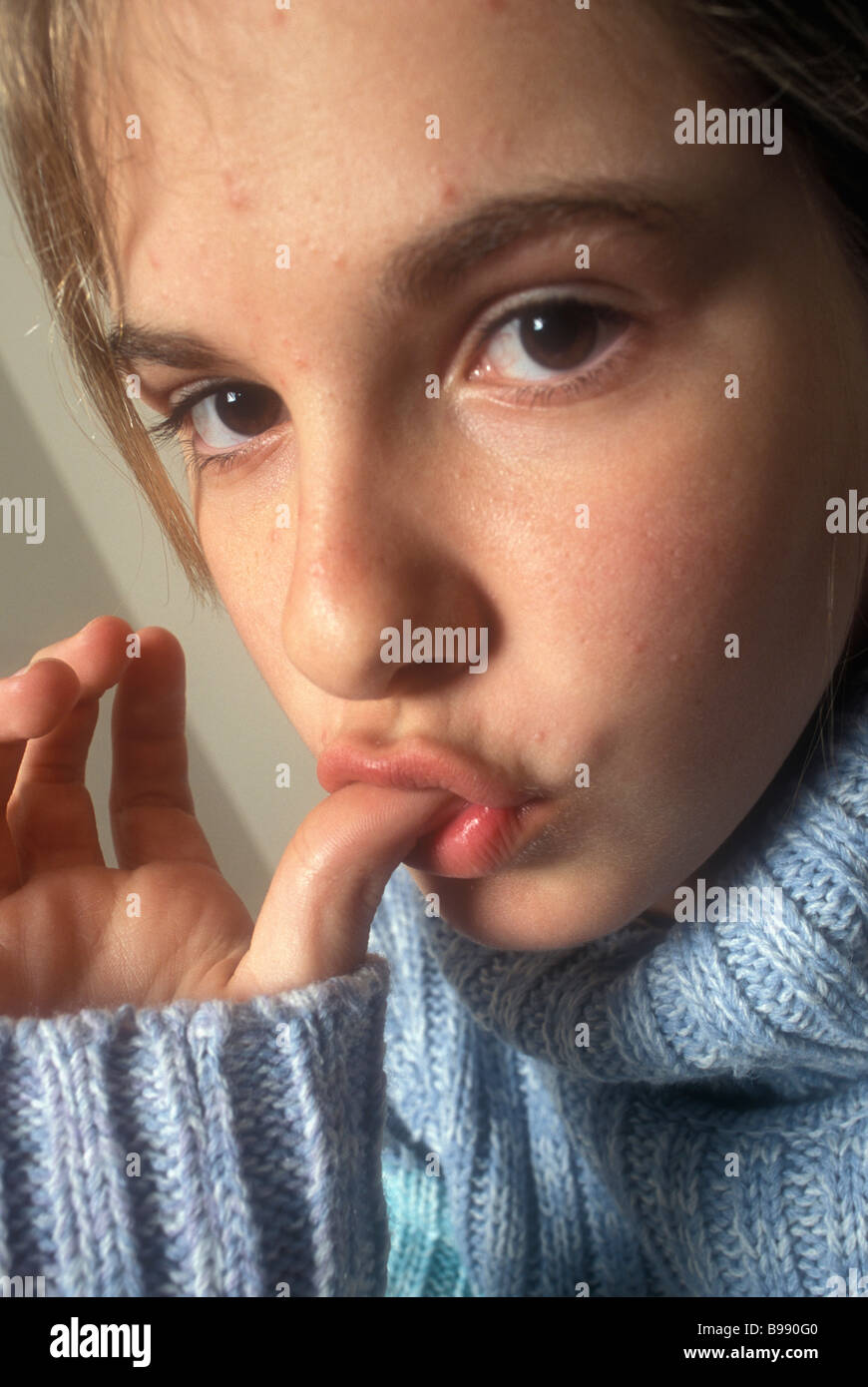 Pouce cassé Banque de photographies et d’images à haute résolution - Alamy