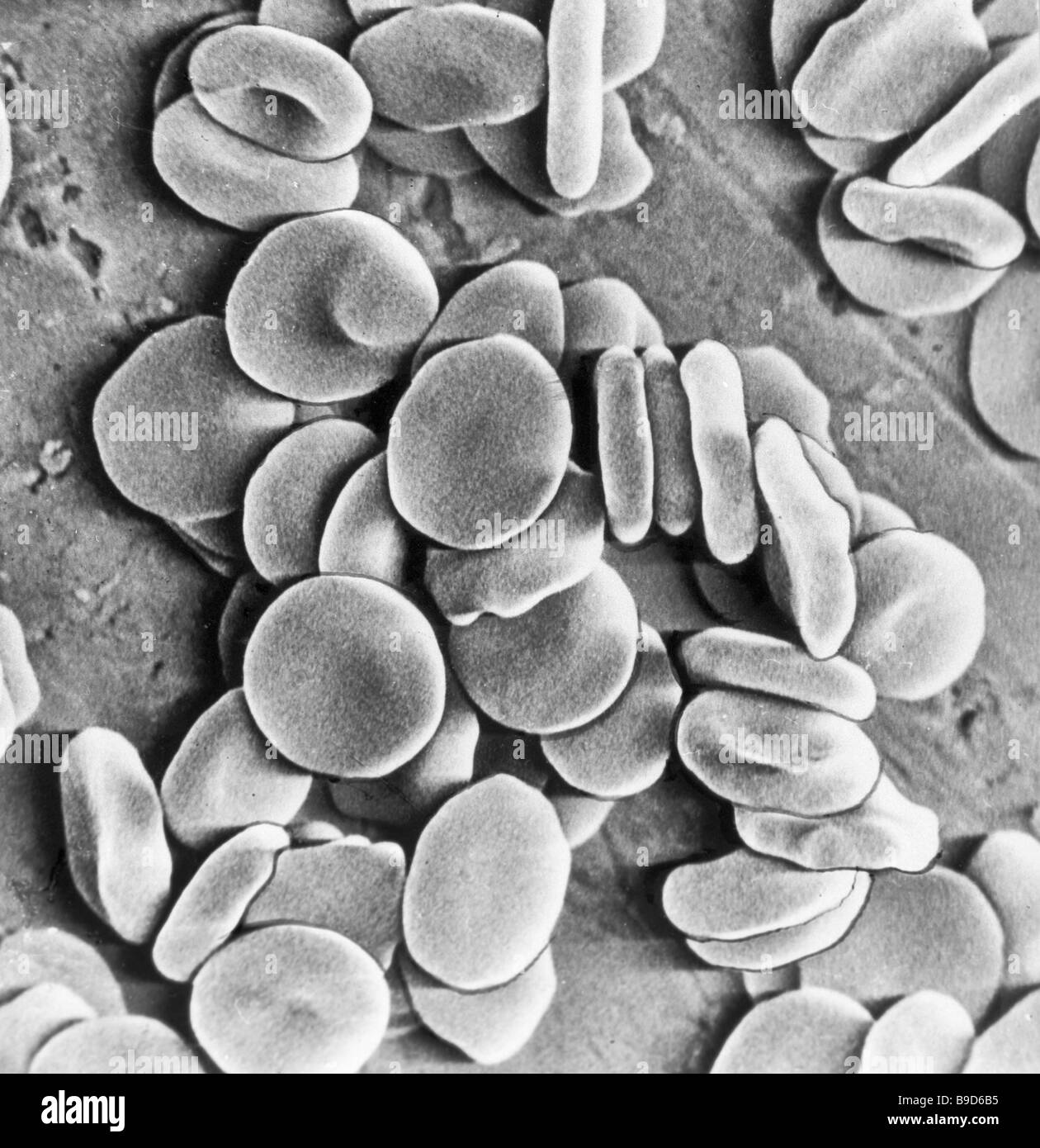 Une personne en bonne santé, les globules rouges amplifié 4200 fois par ...