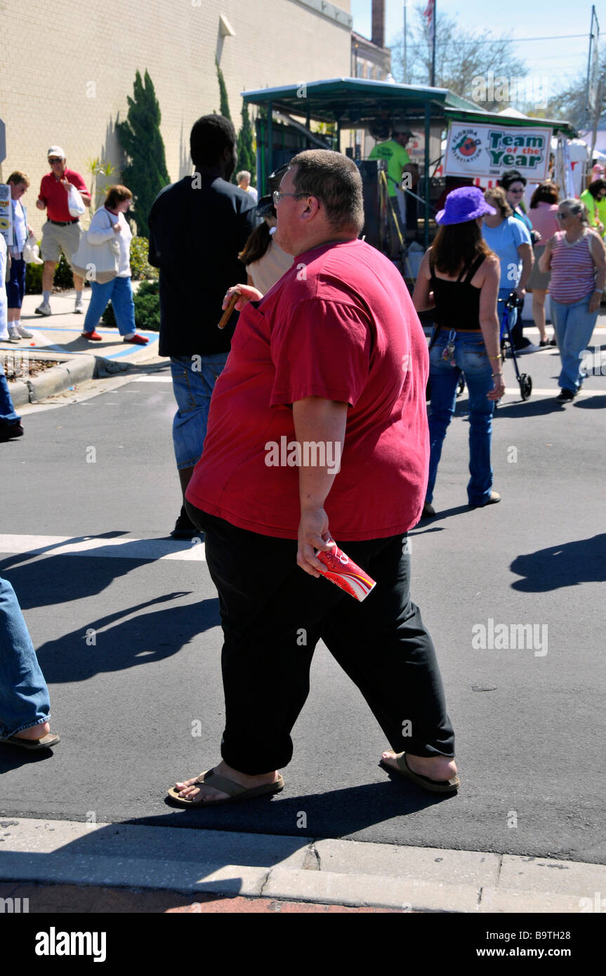 Morbidly obese male Banque de photographies et d’images à haute ...