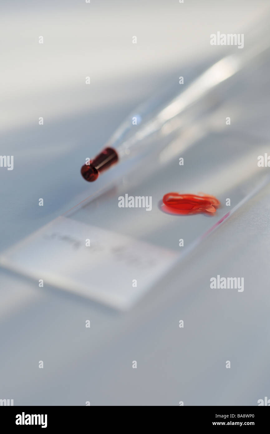 Vue au microscope sang Banque de photographies et d’images à haute ...