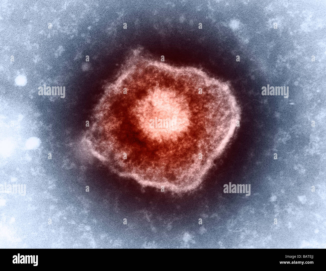 Varicella zoster micrograph Banque de photographies et d’images à haute ...