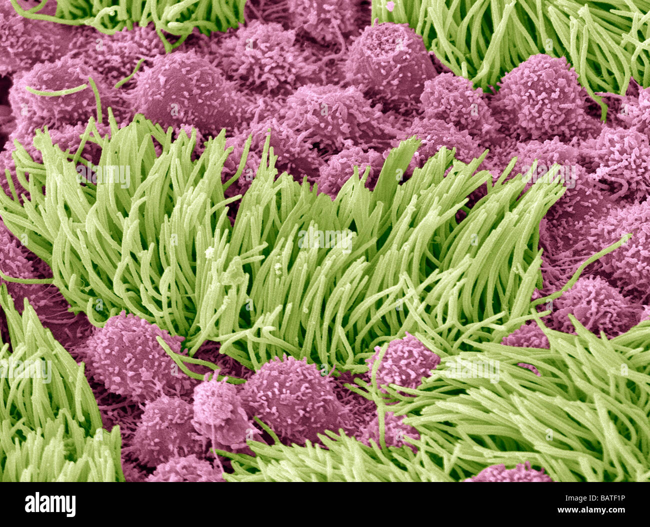 Les trompes de Fallope. Couleur de l'analyse des electronmicrograph ...