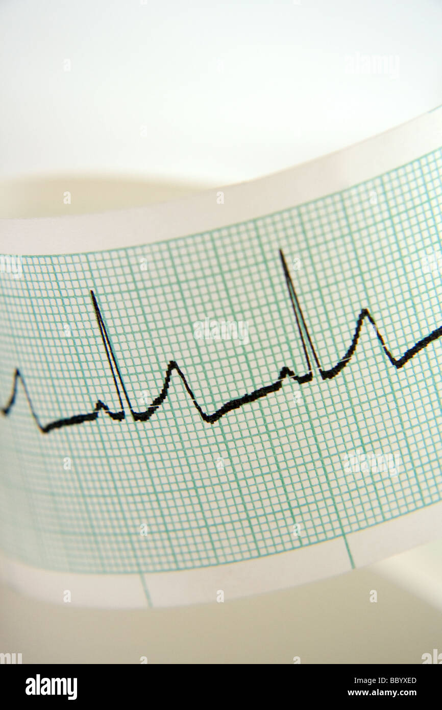 Ekg ecg Banque de photographies et d’images à haute résolution - Alamy