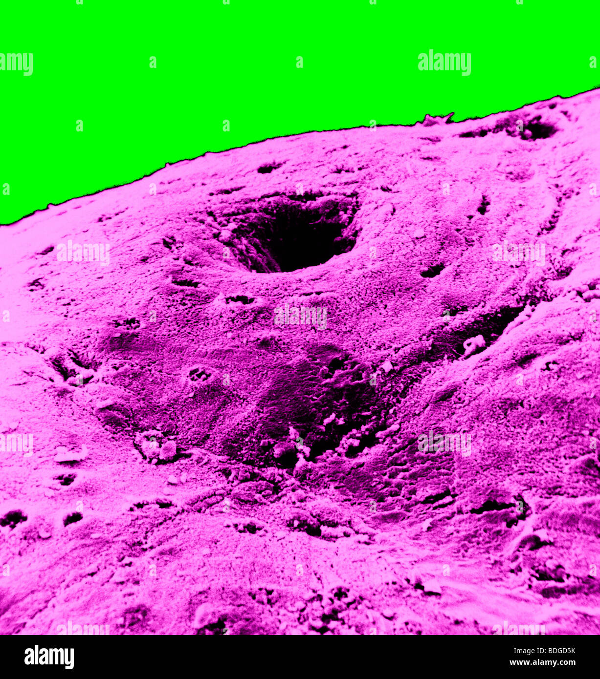 Muqueuse du colon Banque de photographies et d’images à haute ...