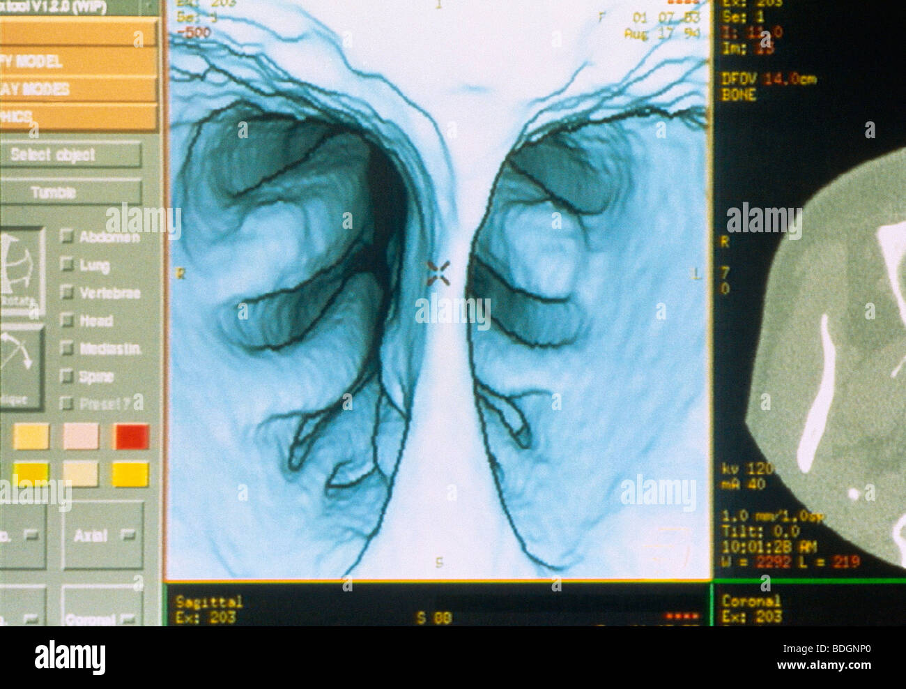 Sinus ct scan Banque de photographies et d’images à haute résolution ...