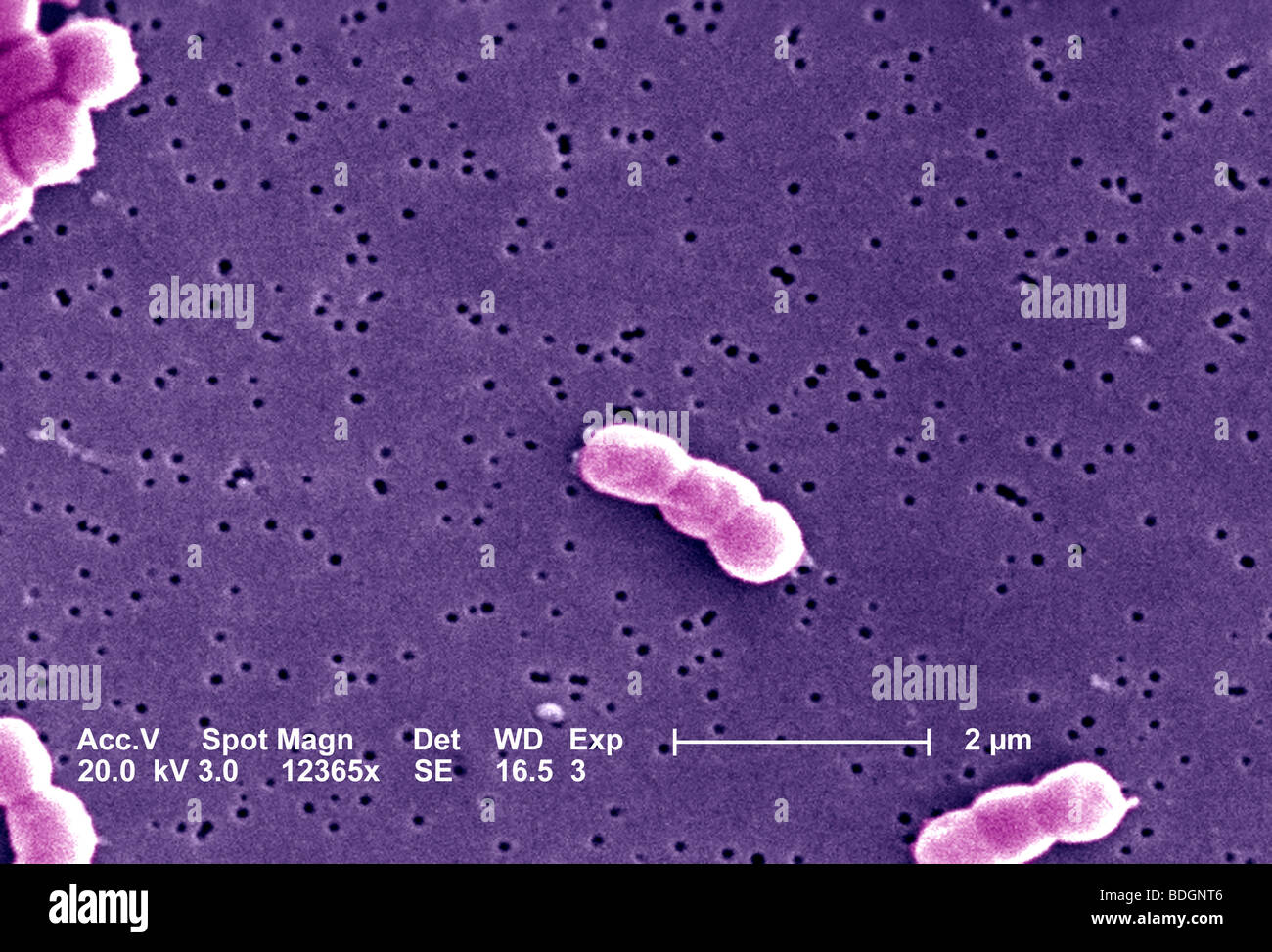 Bactérie acinetobacter Banque de photographies et d’images à haute ...