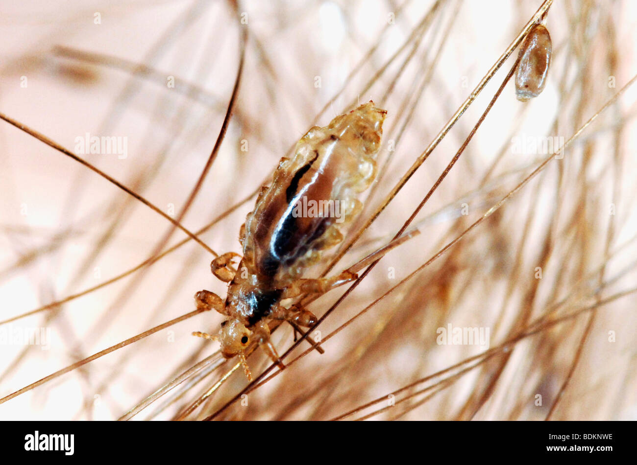 Pou de corps Banque de photographies et d’images à haute résolution - Alamy