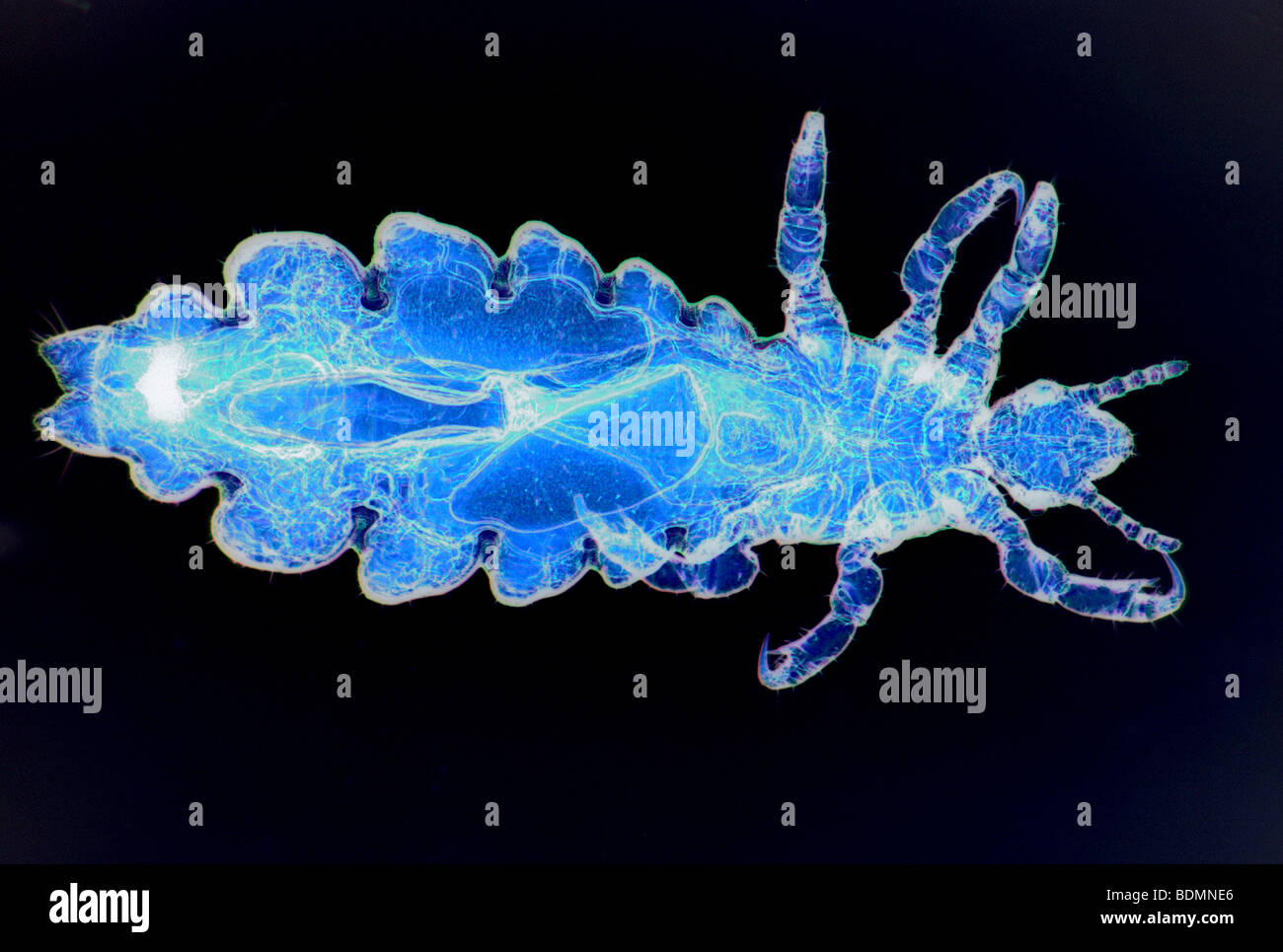 Photomicrographie de poux de tête d'une femelle, ou Pediculus humanus ...