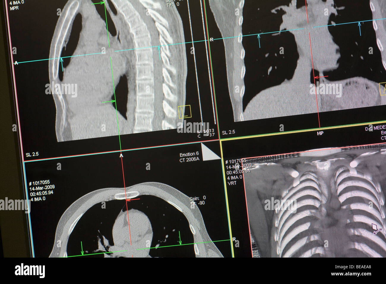 Cat scan Banque de photographies et d’images à haute résolution - Alamy