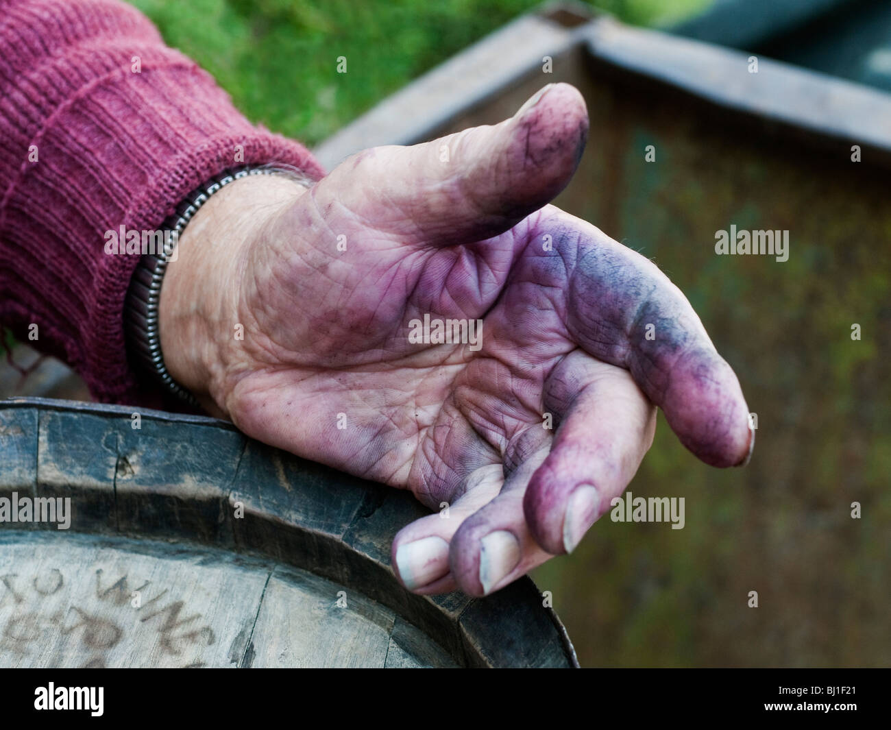Tache macule violette peau Banque de photographies et d’images à haute ...