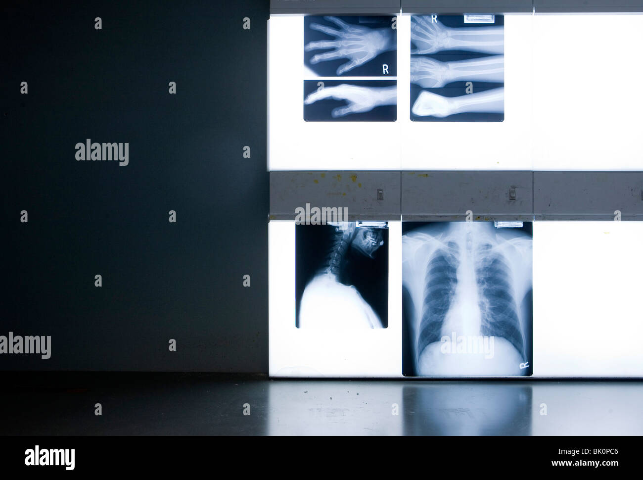 Radiografia de un cuerpo humano Banque de photographies et d’images à ...