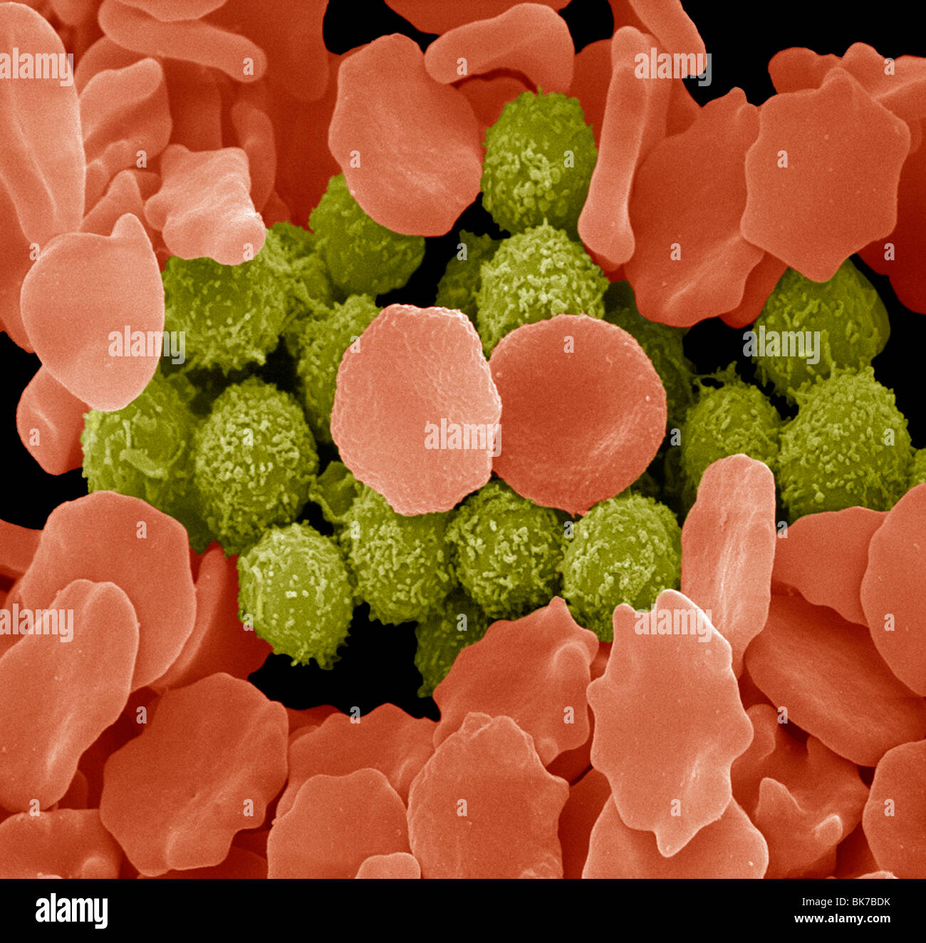 Light micrograph red blood cells Banque de photographies et d’images à ...