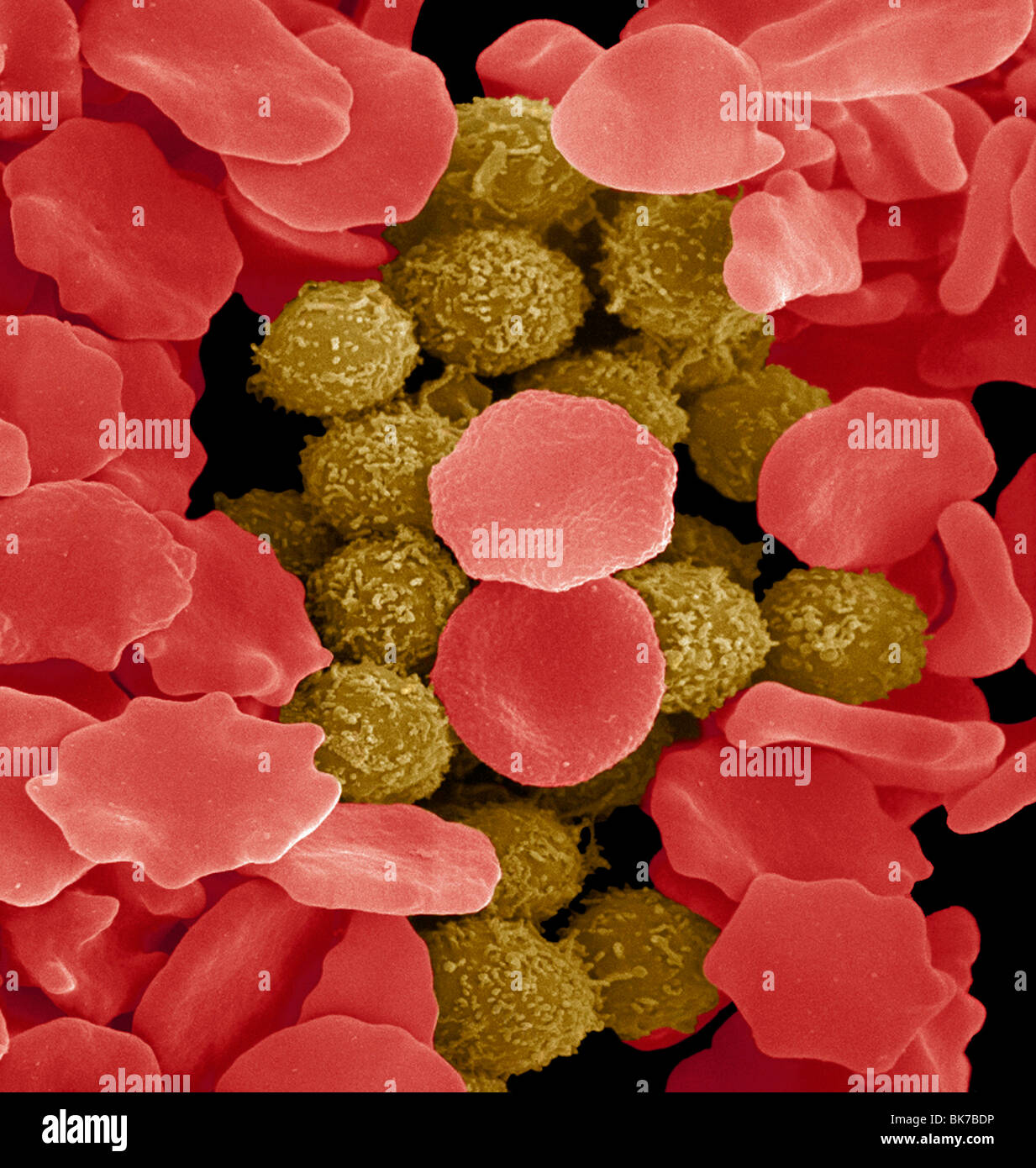 Light micrograph red blood cells Banque de photographies et d’images à ...