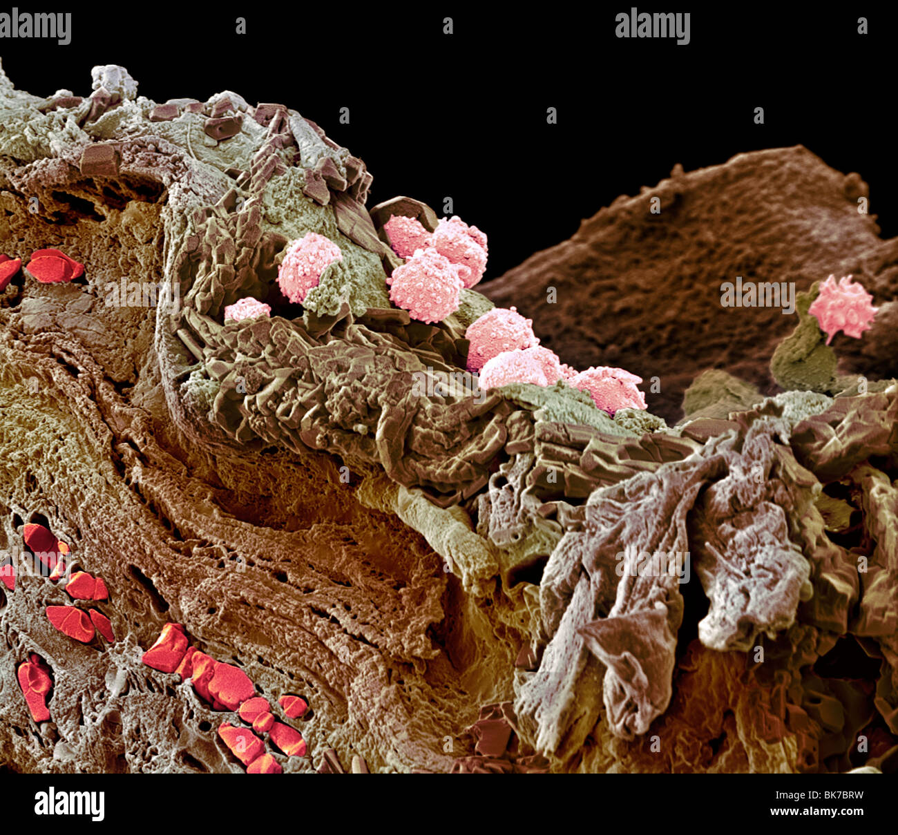 Light micrograph red blood cells Banque de photographies et d’images à ...