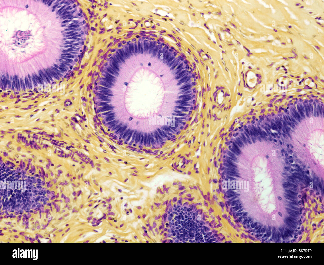 De l'épididyme, light micrograph Photo Stock - Alamy