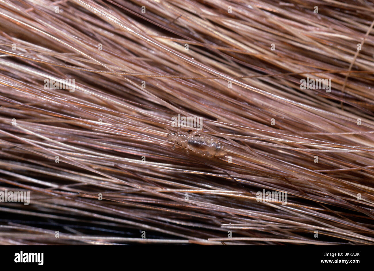 Pediculus Humanus Capitis Banque d'image et photos - Alamy